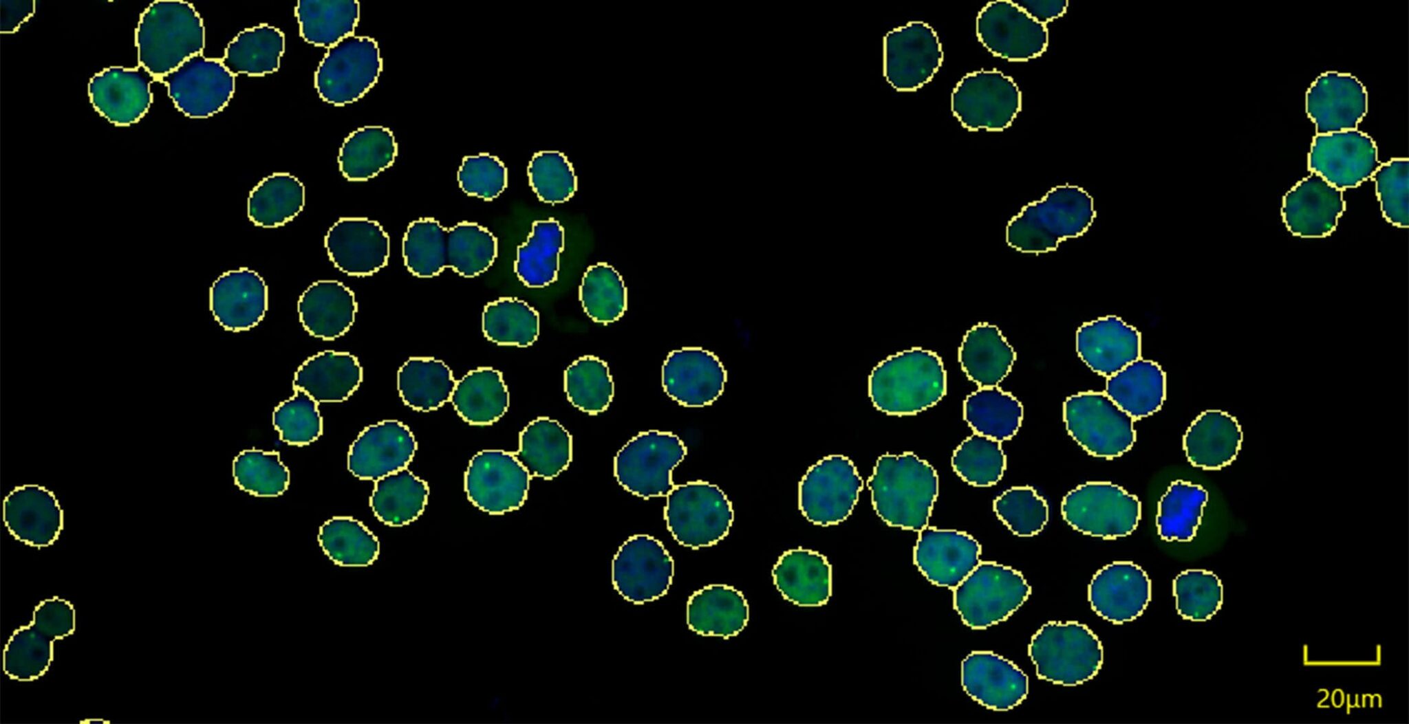 Imaging Single-Cell Gene Transcription - Life Innovation Blog
