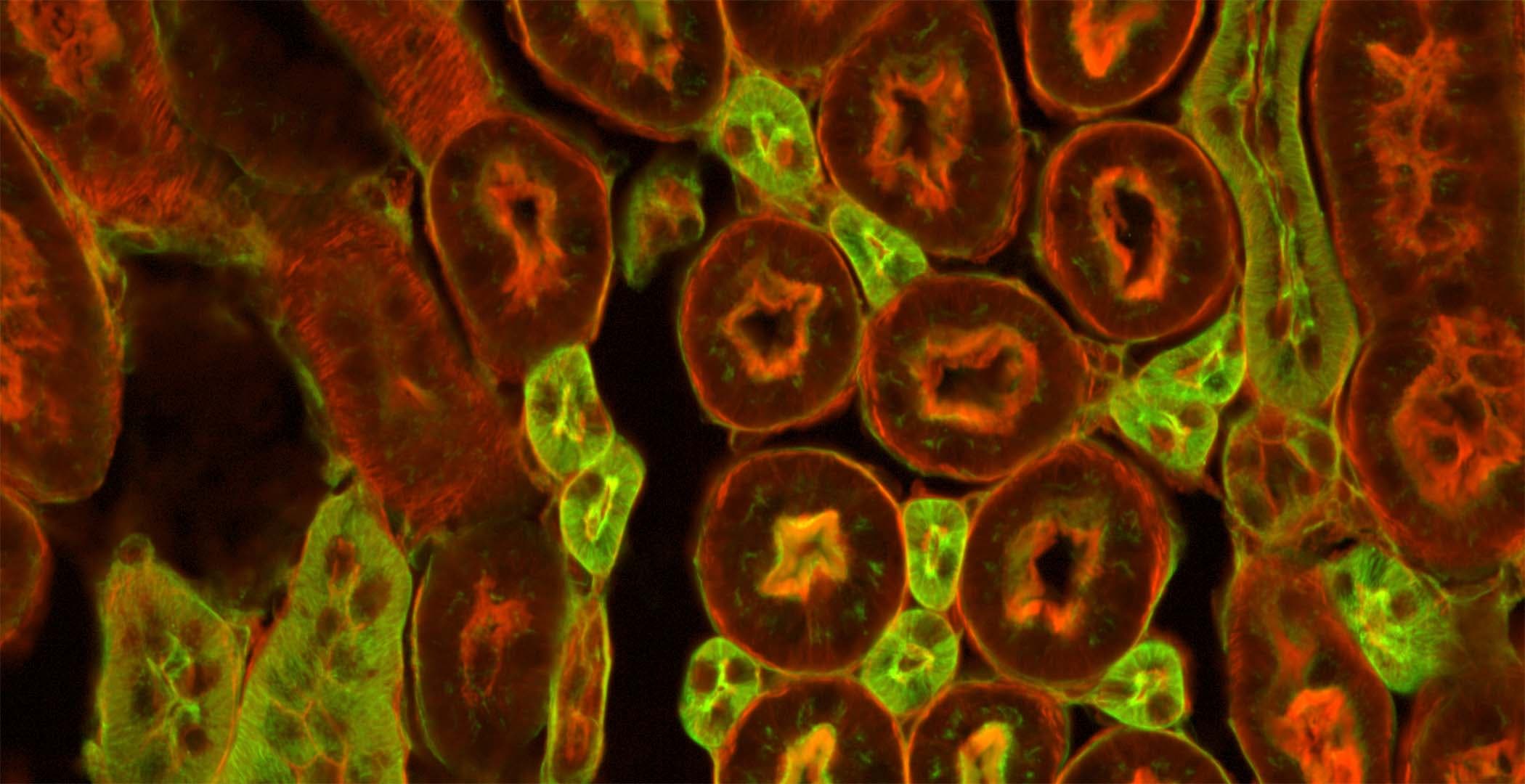 Single-cell Metabolomics and Proteomics - Life Innovation Blog